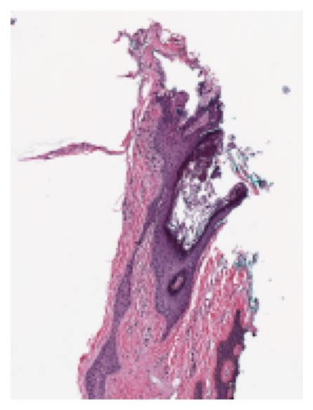 stain normalization tia toolbox 1 5 1 documentation