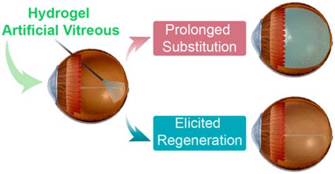 Hydrogels For Artificial Vitreous From Prolonged Substitution To