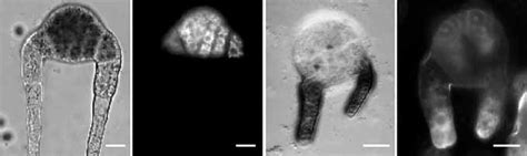 Rhizoid Development In Unilateral Light Is Normal In Twinned Embryos