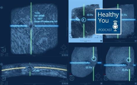 Ai Enhanced Breast Cancer Screening Northshore