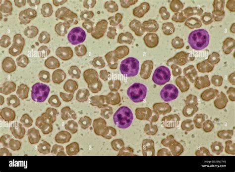 Light Micrograph Of Normal Human Blood Cells Stock Photo Alamy