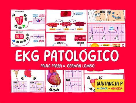 Nodulo Sinusal Y Bloqueos CardÍacos Ekg Patologico Sustancia P Studocu