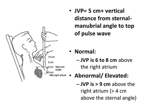 History Taking And Physical Examination Of Cardiovascular System The