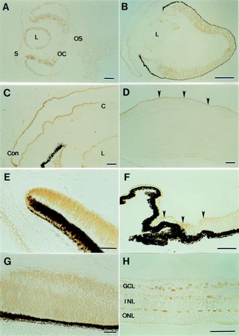 Pax6 Expression In The Developing Human Eye Pmc