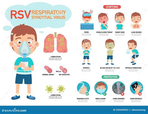 Rsv Respiratory Syncytial Virus Infographic Stock Vector Illustration Of Biology Cough 259449032