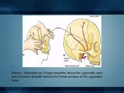 Craniometric Points Pptx