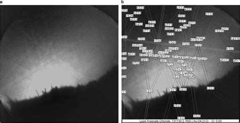 Electron Backscattered Diffraction Patterns A And Their Indexation