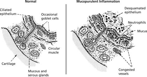 Respiratory System Basicmedical Key