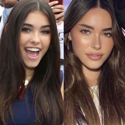 Madison Beer Plastic Surgery Plastic Surgery Madison Beer Madison