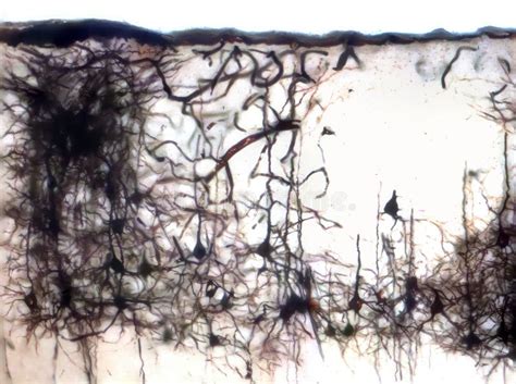 Golgi Stain Brain Stock Image Image Of Microscope 327438755
