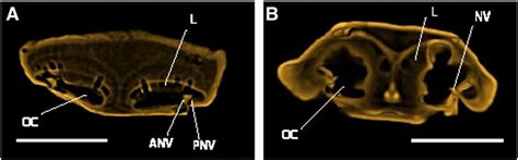Three Dimensional Volume Rendering Of The Olfactory Cavity Of The A