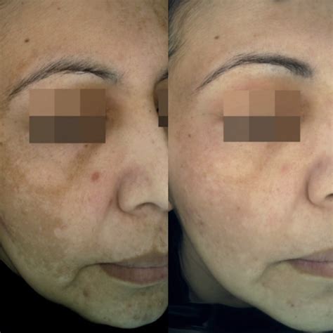Image Gallery Derma Revive Skin Clinic