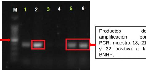 Preparación De Solución De Lisis Buffer De Lisis