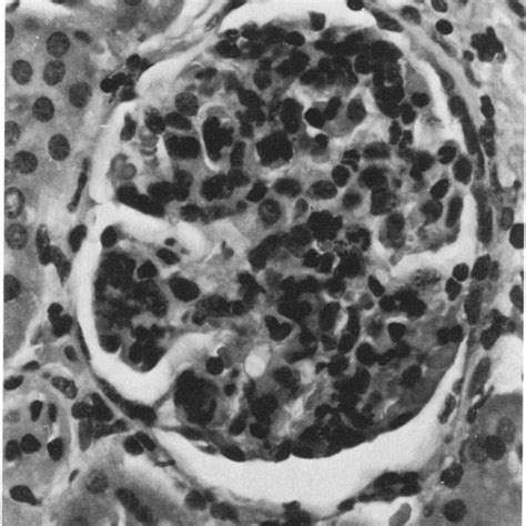 Direct Immunofluorescence Photomicrograph Of A Glomerulus From A Swiss