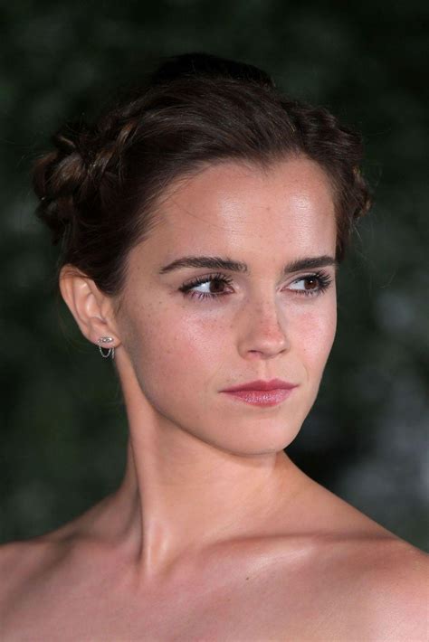 Emma Watson Aparelho Antes Depois