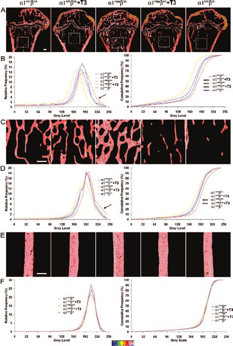 Trabecular And Cortical Bone Mineralization In Untreated And T 3