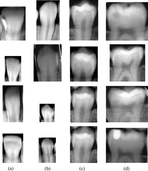 Sample Of Teeth Used In Constructing The Image Subspaces Of The Four