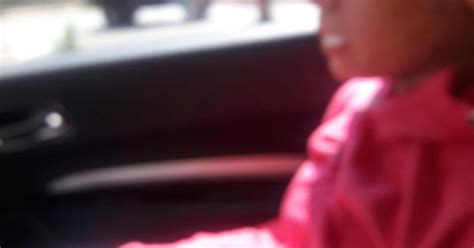 Today I Got My Widsom Teeth Out Album On Imgur