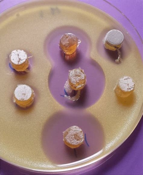 Bioassay Diffusion Assays Using Micrococcus Luteus As Indicator