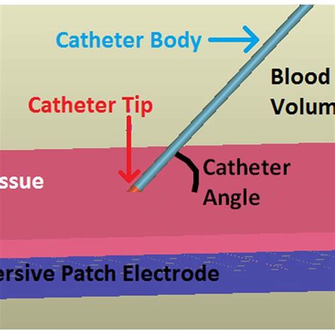 Sample Ablation Model Setup Sample Ablation Model Illustrating The Two Download Scientific