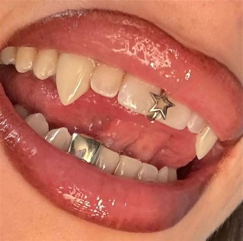 Pin By ⚰️ 𝕷𝖆𝖞𝖑𝖆 ⚰️ On Billie ♡ Grills Teeth Billie Billie Eilish
