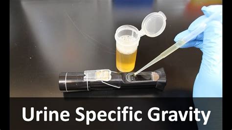 Urinalysis Low Specific Gravity At Carolyn Huddleston Blog