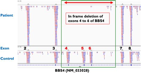 Igv Illustration Igv Illustration Of The Homozygous Exon 4 To 6