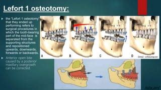 Indications And Pre Prosthetic Procedures For Making Prosthesis Dr