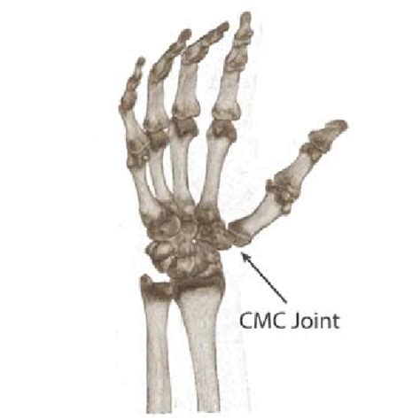 A Three Dimensional Rendering Of A Ct Scan Of A Right Hand With The