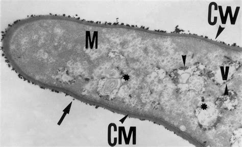Mucor Javanicus Cell Wall Cw Cytoplasmic Membrane Cm Download Scientific Diagram