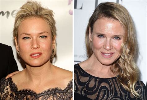 Renee Zellweger Before And After From 1997 To 2022 Celebrity Plastic