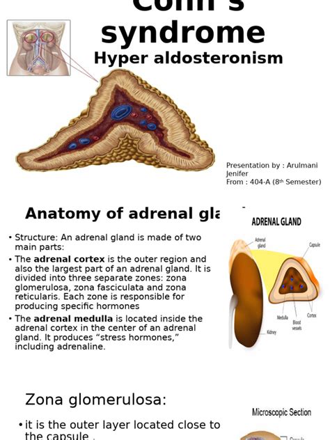 Conns Syndrome Pdf Adrenal Gland Endocrine System