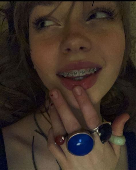 Pin By öznur On Ive Got My Eye On You Cute Braces Braces Girls