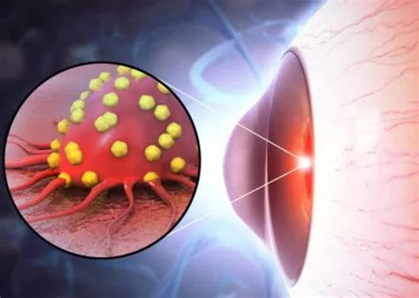 眼睛也会长肿瘤？眼球、眼眶、眼睑上的肿瘤都有哪些？ 12健康