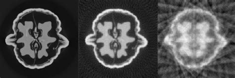 Tomographic X Ray Data Of A Walnut Fips