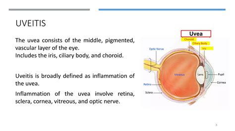Acute Anterior Uveitis By Dr Rubanapptx