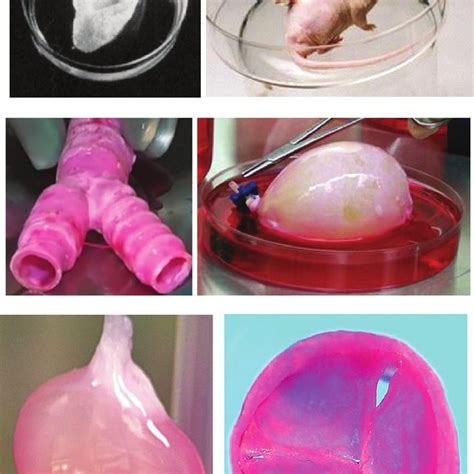 2 The Triad Of Tissue Engineering The Combination Of Cells Scaffolds Download Scientific