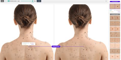 Mole Mapping Melbourne Cbd
