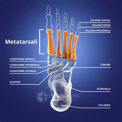 Frattura Metatarso Cause Tempi Di Recupero Fisioterapia