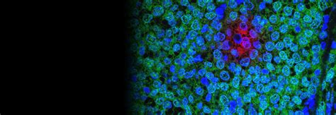 Womens Malignancies Branch Center For Cancer Research National