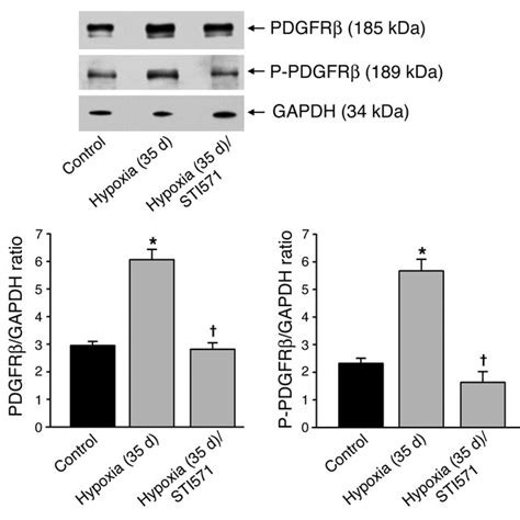 Increased Pdgfrβ Expressionphosphorylation In Hypoxia Induced
