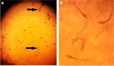 Treated Cercariae Observed Under A Dissecting Microscope ×10 Showing