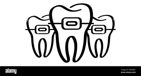 Orthodontic Dental Care Bracket Or Brace Teeth Dentist Braces Cartoon Healthy Tooth With