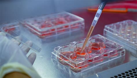 Serology Testing Health Monitoring