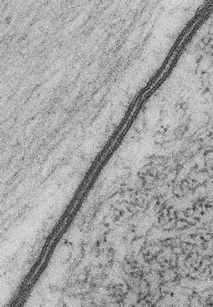 Biol 230 Lecture Guide Electron Micrograph Of A Cytoplasmic Membrane