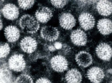 negatively stained electron micrograph of rotaviruses encyclopedia mdpi