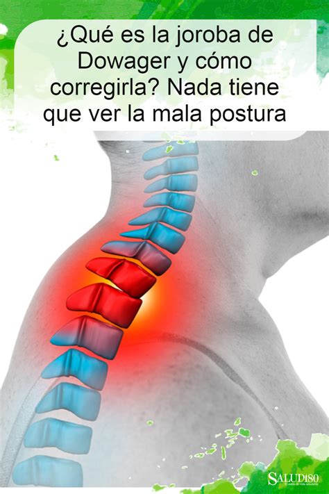 Como Eliminar La Joroba De Bufalo