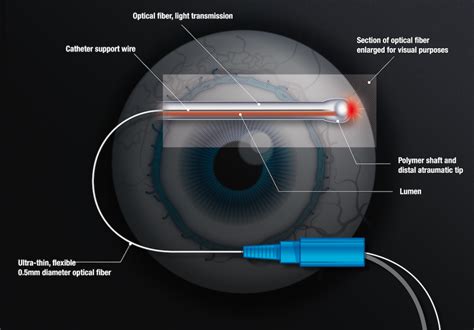 Abic™ Ophthalmic Singapore