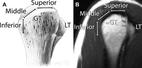 Novel Anatomic Concepts In Magnetic Resonance Imaging Of The Rotator