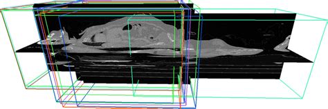 Sparsity Induced By A Panoramic Reconstruction With BA Top Compared